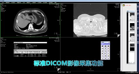 大型医院影像pacs系统三维重建技术（获取数据、预处理、配准、重建和可视化）医学图像配准与可视化系统 Csdn博客