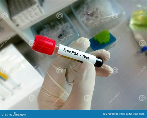 Free Psa Test Diagnosis Of Prostate Cancer Stock Image Image Of