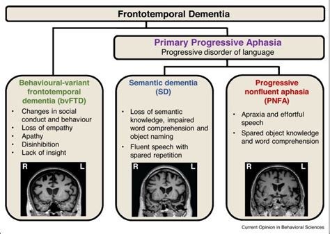 Frontotemporal Dementia What Is It