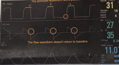 Waveforms Practice Flashcards Quizlet