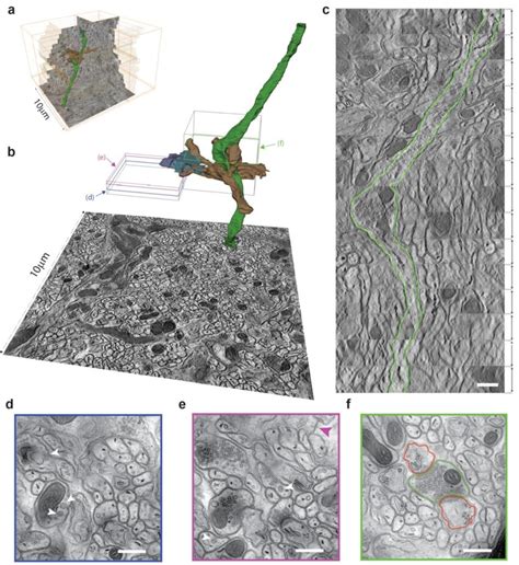 Examples Of Et Volume Stitching Segmentation And Multi Resolution