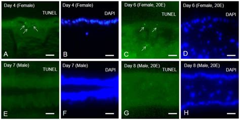 Tunel Assays Green A C E G And Dapi Staining Cyan B D F H
