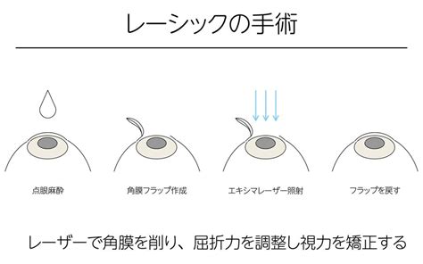 Premium Vector Eye Disease Illustration Of Age Related Macular