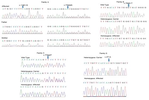 Sanger Sequencing Results Of Participated Families A Sanger Download Scientific Diagram