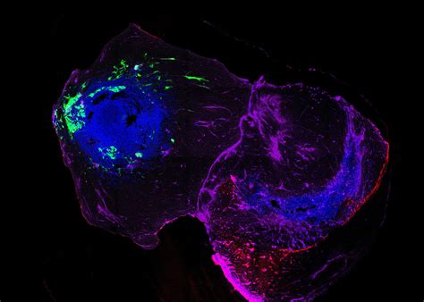 Lcsb Scientists Reveal Parkinsons Disease Spread Using Brain