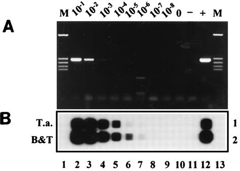 Simultaneous Detection Of Bovinetheileria And Babesia Species By Reverse Line Blot Hybridization