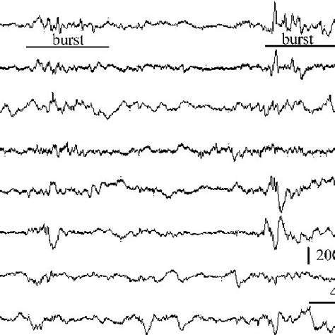Pdf On The Spatio Temporal Organisation Of Quadratic Phase Couplings In Tracé Alternant Eeg