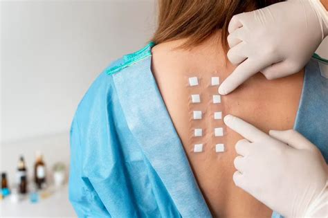 Skin Patch Test