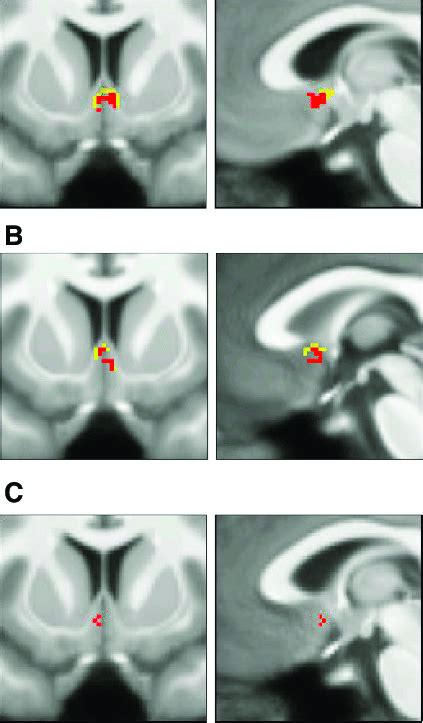 Basal Forebrain Activations By ε 3 Download Scientific Diagram
