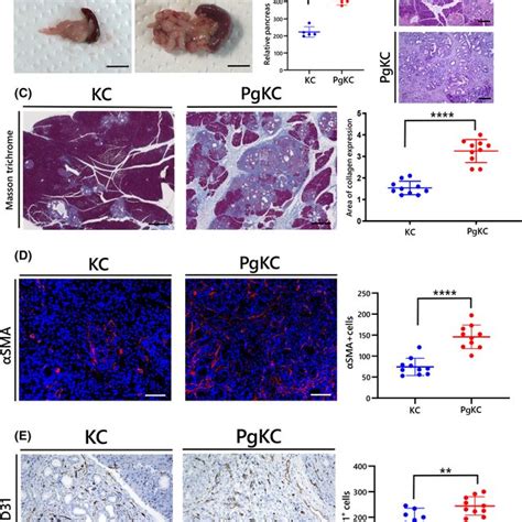 Genetic Deletion Of 15‐pgdh Favors Fibrosis And Angiogenesis In A Pdac Download Scientific