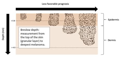 Treatment Northwestern Medicine