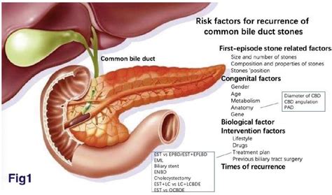 Common Bile Duct