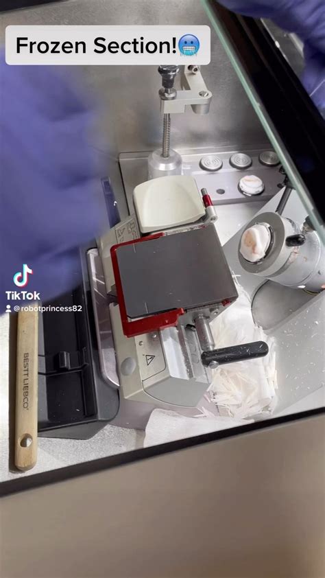 What Is A “frozen Section” The Frozen Section Procedure Is A Pathological Laboratory Procedure