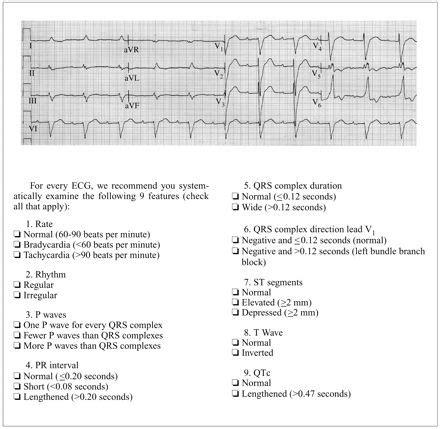 Wide QRS Duration Nursing Mnemonics Critical Care Nursing Nurse