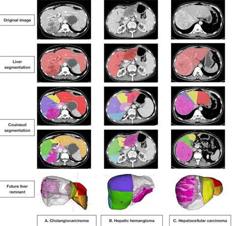 Examples Of Successful Automated Segmentations In Candidates For Major Download Scientific