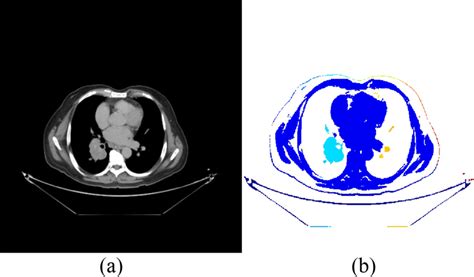 A Input Image B Labeled Output From Connected Component Labeling Download Scientific Diagram