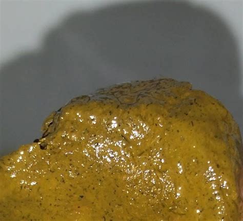 What Causes Your Poop To Be Yellowish At Mary Bevis Blog