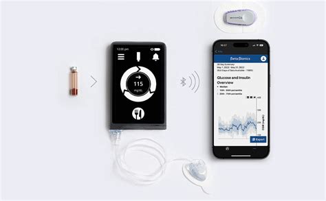 Bionic Pancreas Approved By Fda