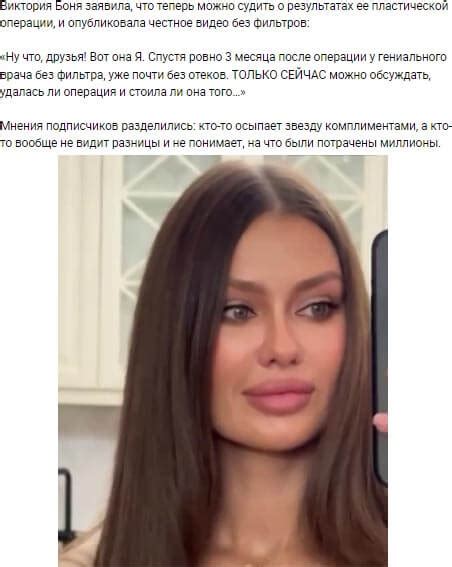 Перештопанная Виктория Боня окончательно сняла повязку и показала лицо новости и слухи дома 2