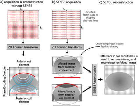 Parallel Imaging Parallel Imaging Uses The Spatial Distribution Of Download Scientific Diagram