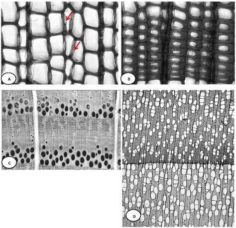 Tracheids Under Microscope