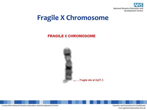 Ppt Fragile X Syndrome Powerpoint Presentation Free Download Id 2983227