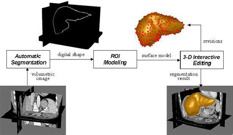The Computer Aided Design System Used In Region Editing The System