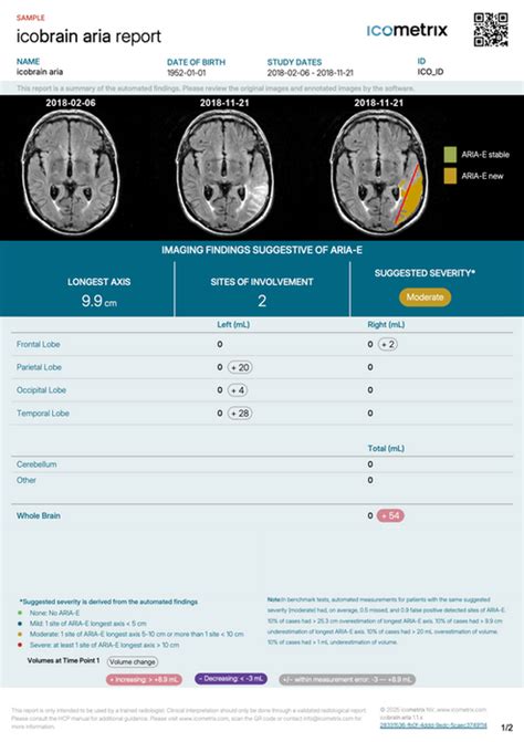 Aria Amyloid Related Imaging Abnormalities Brain Mri Ai Detection