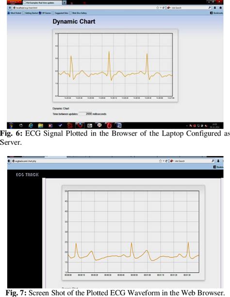Figure From IOT Based Real Time ECG Monitoring Of Rural Cardiac Patients Semantic Scholar