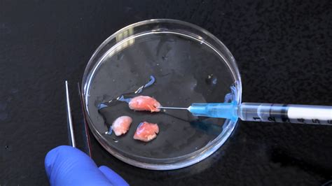 Video Characterization Of Immune Cells And Proinflammatory Mediators In The Pulmonary Environment