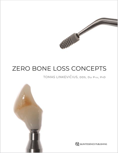 Zero Bone Loss Concepts Dentwoo