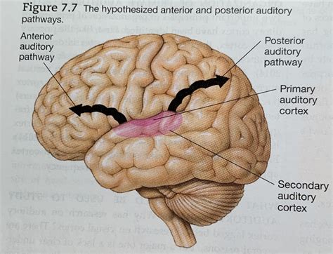 Secondary Auditory Cortex