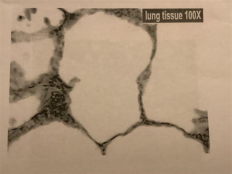 Simple Squamous Diagram Quizlet