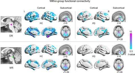 Within‐group Functional Connectivity Fc Of Raphe Nuclei Results Are Download Scientific