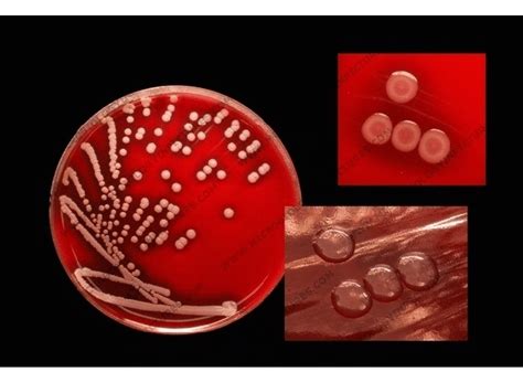 Staphylococcus Saprophyticus Colony Morphology Staphylococcus Aureus