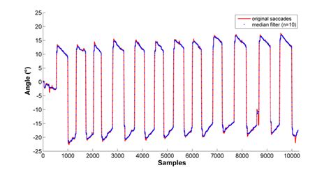 Saccadic Response Signal To The 30° Stimulus Before And After The