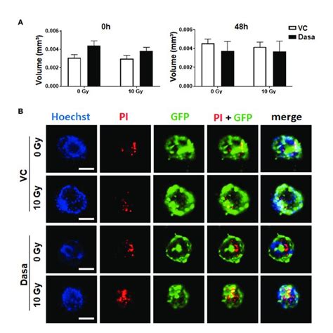 Stromal Fibroblasts Limit The Radiosensitizing Effect Of Src