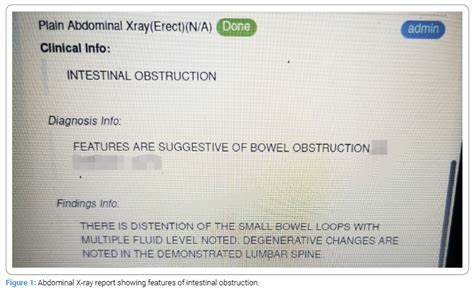 A Rare Case Of Recurrent Intussusception In An Adult Secondary To Signet Ring Cell Carcinoma Of