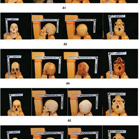 Five Crania Used In Analysis To Estimate Race And Sex Each Cranium Is Download Scientific