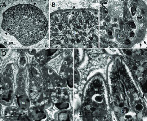 Transmission Electron Microscopy Micrographs Of The Toxoplasma Gondii