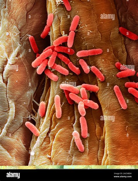 E Coli Bacteria Coloured Scanning Electron Micrograph Sem Of Escherichia Coli E Coli