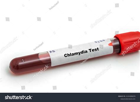 Chlamydia Test Medical Check Test Tube Stock Photo Shutterstock
