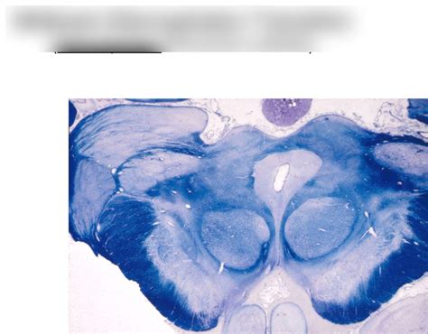Midbrain Diencephalon Diagram Quizlet