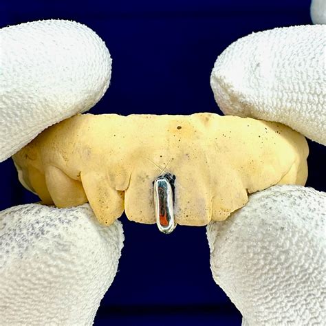 Single Tooth Separator Grillz Water Atl