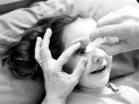 Bacterial Vs Viral Conjunctivitis Differences And Pictures