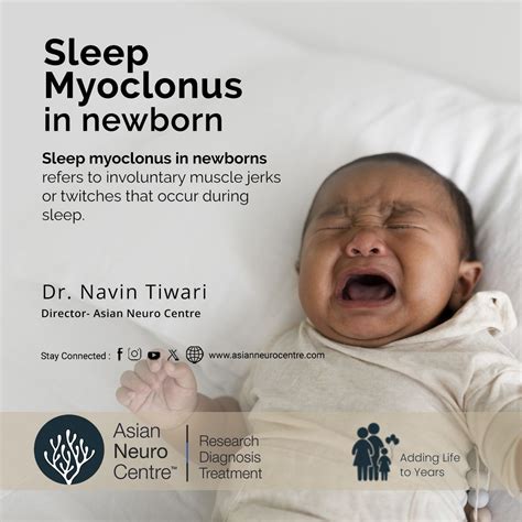 Dr Navin Tiwari On Linkedin Sleepmyoclonus Seizures Myoclonus Neuroscience Neurology