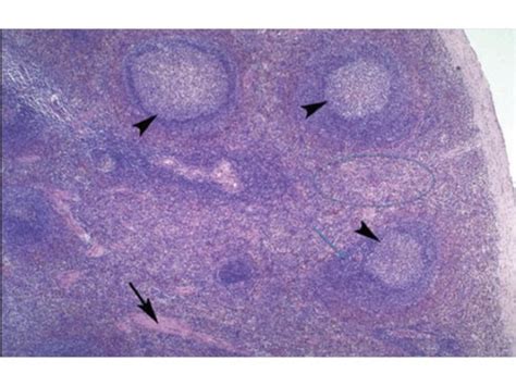 Spleen Slide Flashcards Quizlet