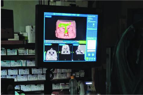 The Fusion Navigation System Used In The Preparation Stage Before The Download Scientific