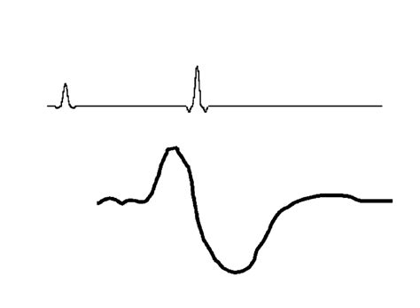 Illustration Of A Spin Echo Pulse Sequence Which Is Optimally Tuned