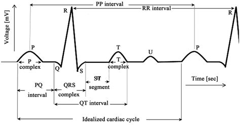Detailed Normal Ecg Signal Download Scientific Diagram